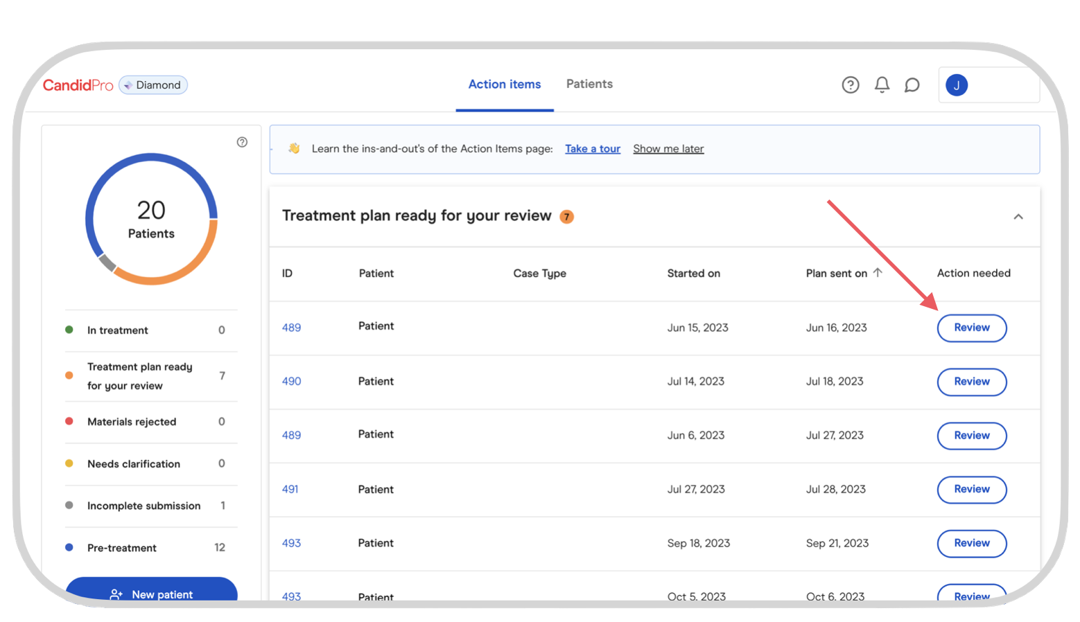 Reviewing, Approving, & Revising your CandidPro Treatment Plan – CandidPro