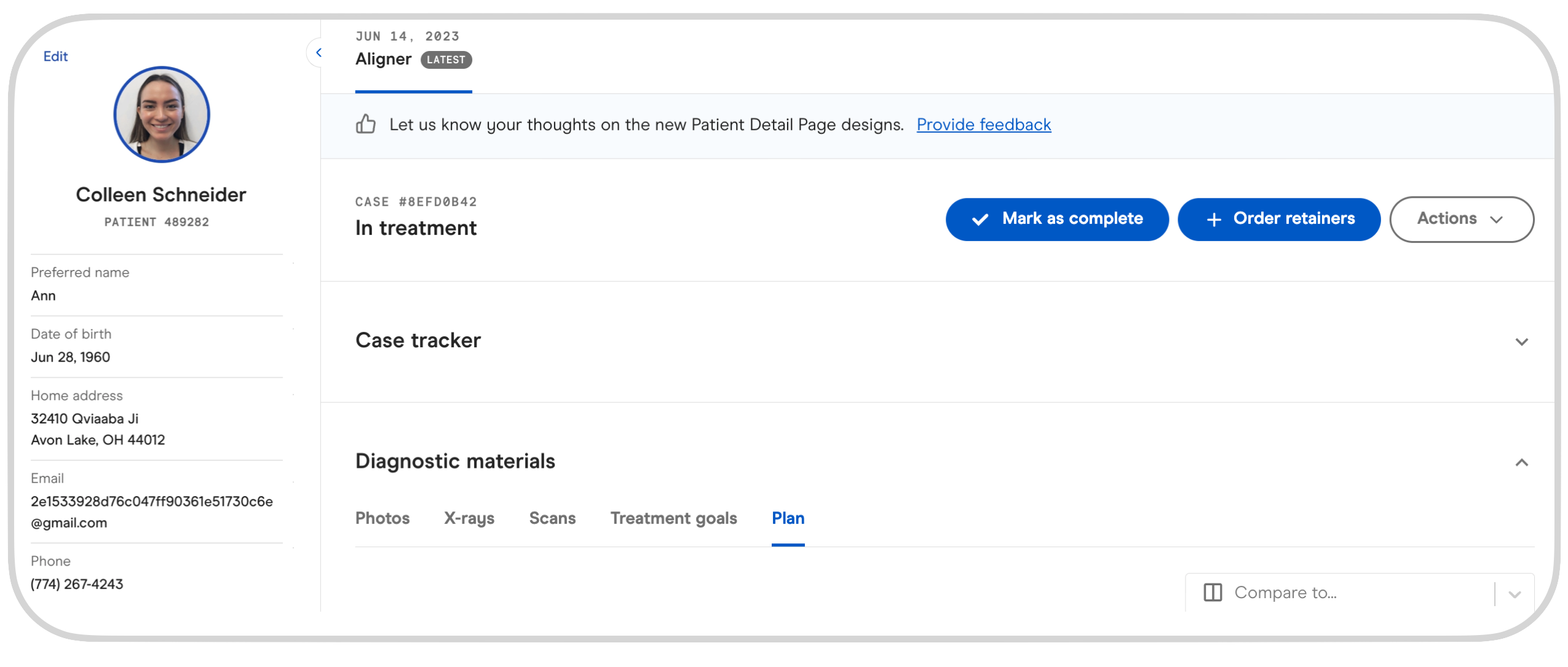 Ordering Retainers – CandidPro