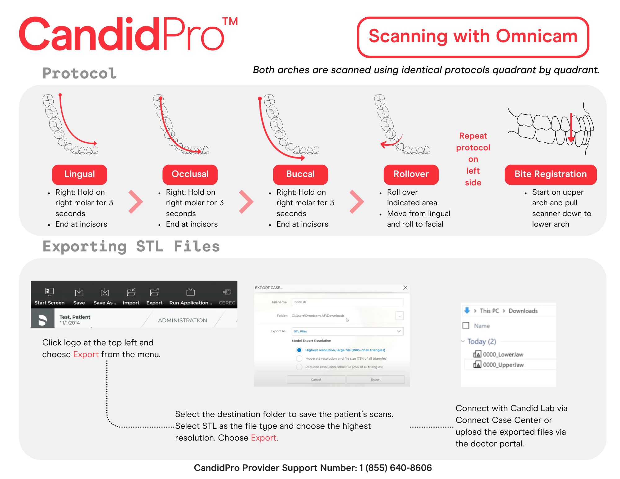 Omnicam Scanner Guide – CandidPro