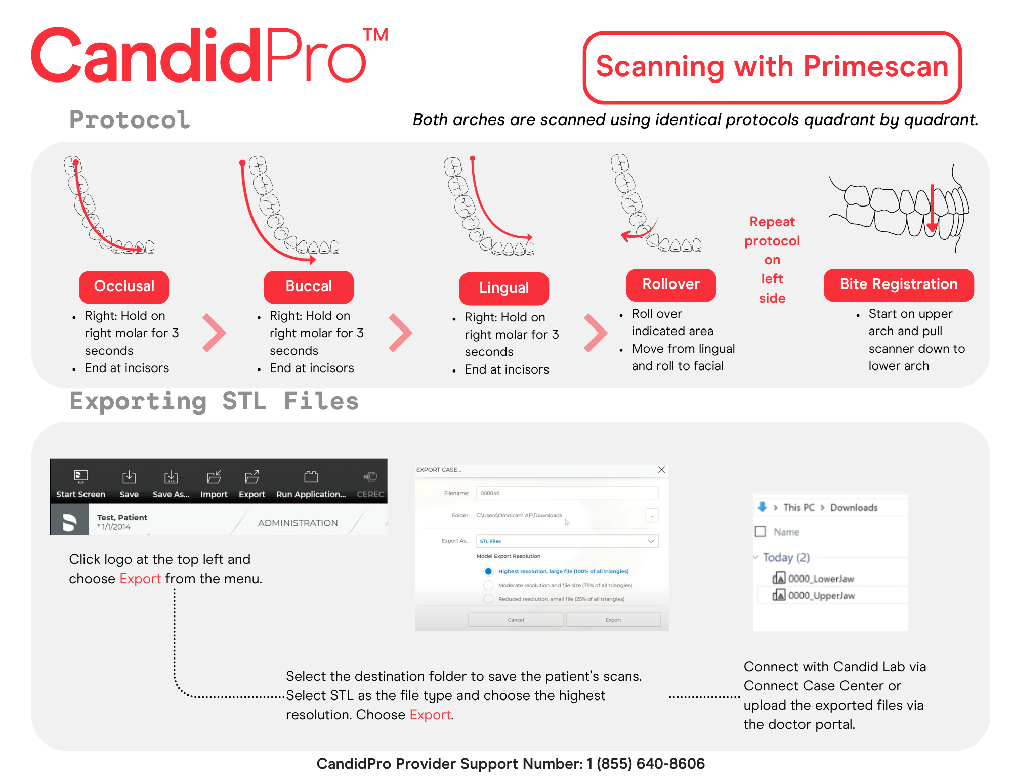 Primescan Scanner Guide – CandidPro