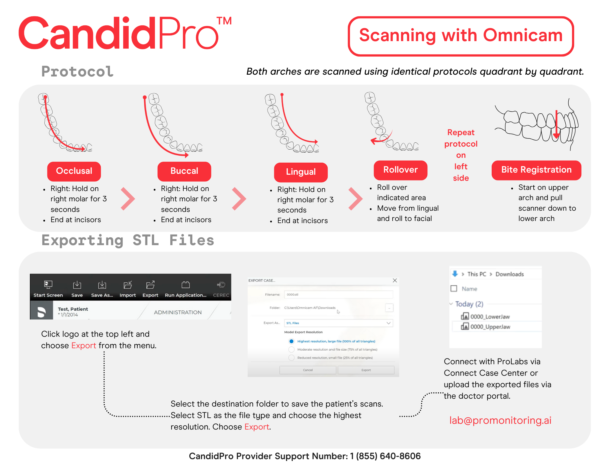 Omnicam Scanner Guide – CandidPro