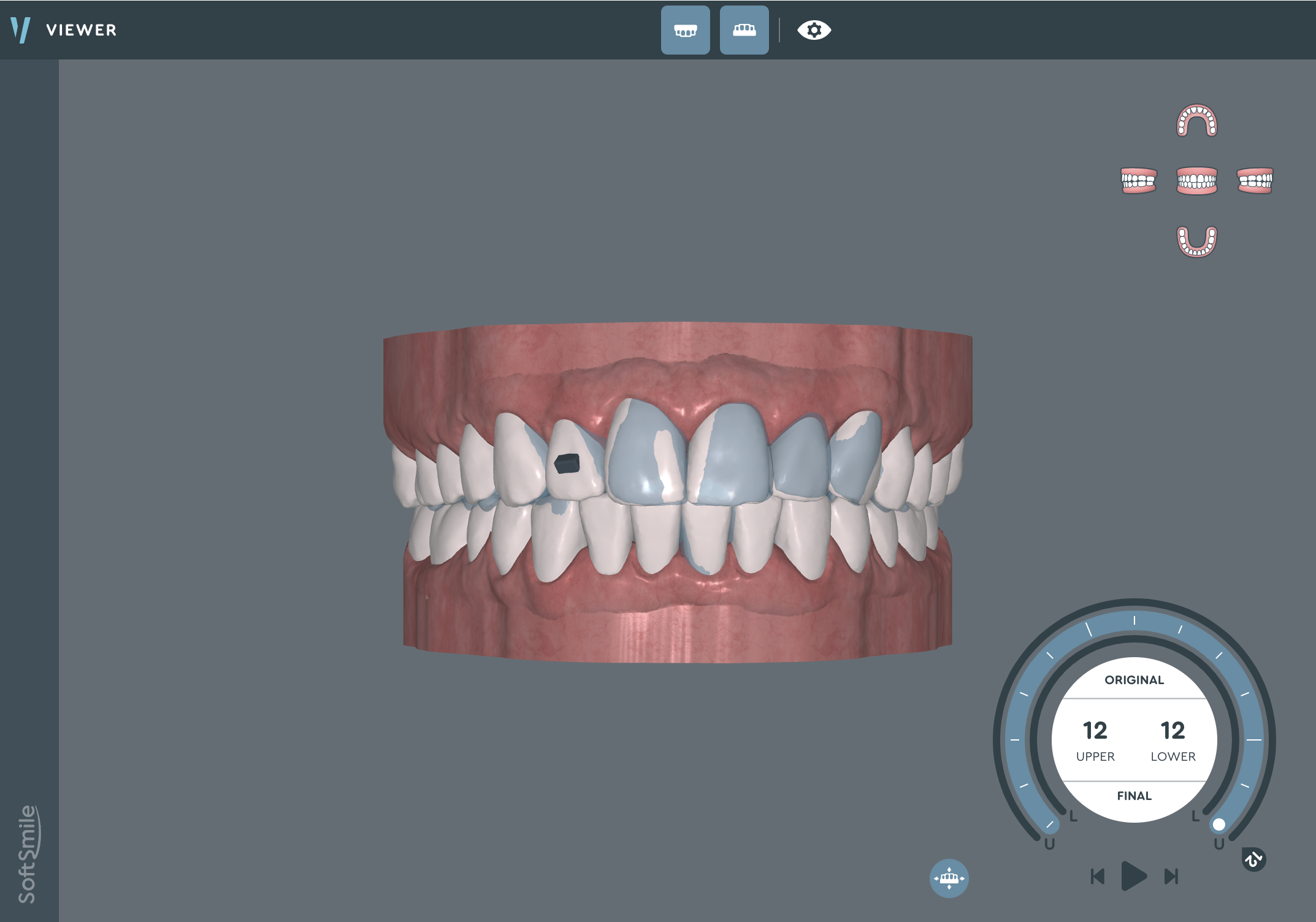 Reviewing, Approving, & Revising your CandidPro Treatment Plan – CandidPro