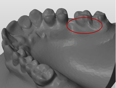 Common Issues with Impressions – CandidPro