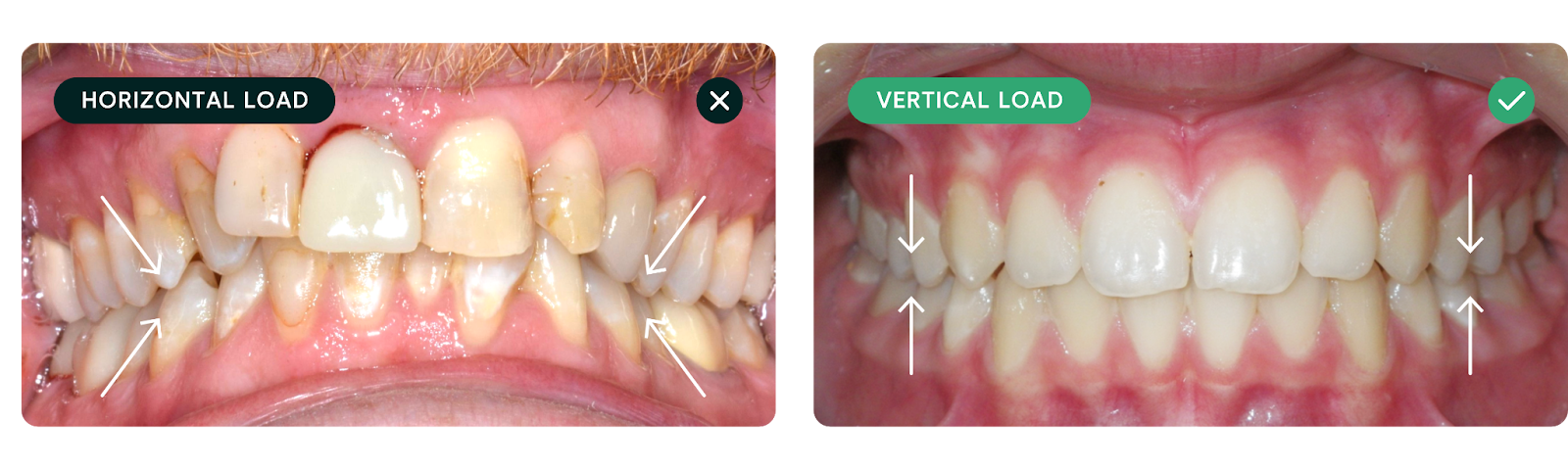 3 Criteria for your Airway Screenings – CandidPro