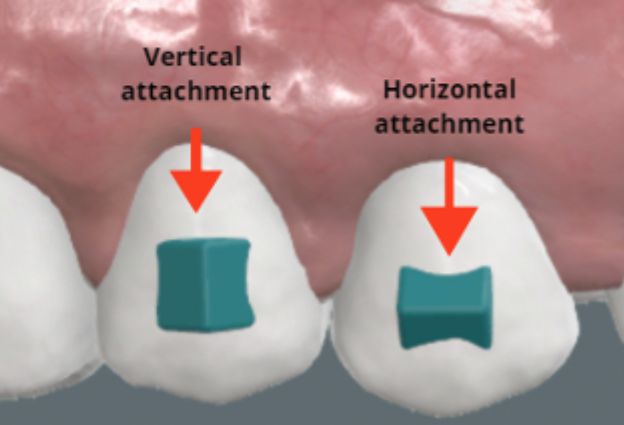 Attachments – CandidPro