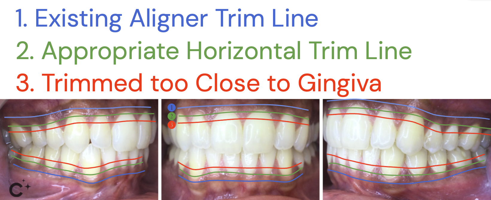Horizontal Aligner Trims – CandidPro